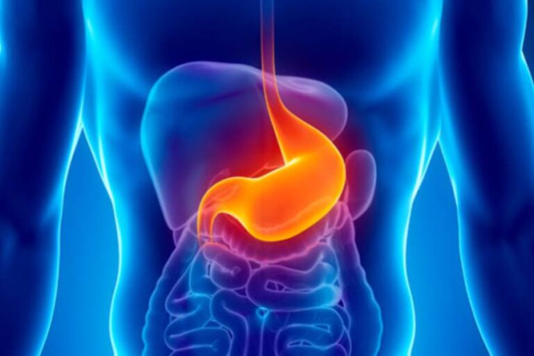 Surgical Gastroenterologist in Chennai | Expert Surgical ...