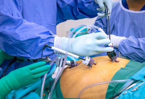 How Robotic Surgery is Transforming Hernia Treatment?_ Dr. Srivatsan.