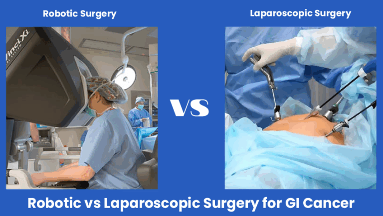 Robotic vs Laparoscopic Surgery for GI Cancer | Dr. Srivatsan Gurumurthy